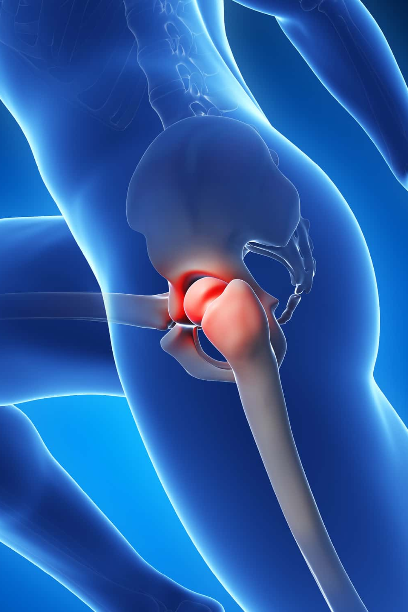 Torn Labrum Treatment with Stem Cell Therapy in Phoenix, AZ | Nulevel ...